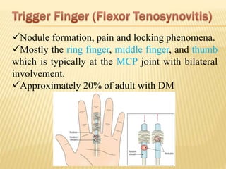 Musculoskeletal Disorders in Diabetes Mellitus | PPTX