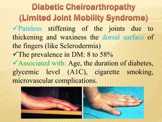 Diabetic Cheiroarthropathy