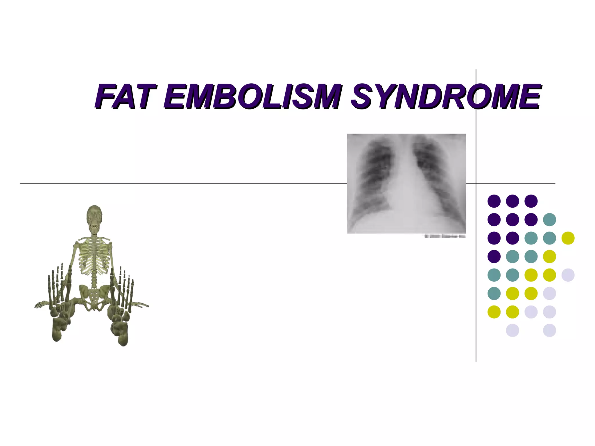 Fat embolism | PPT