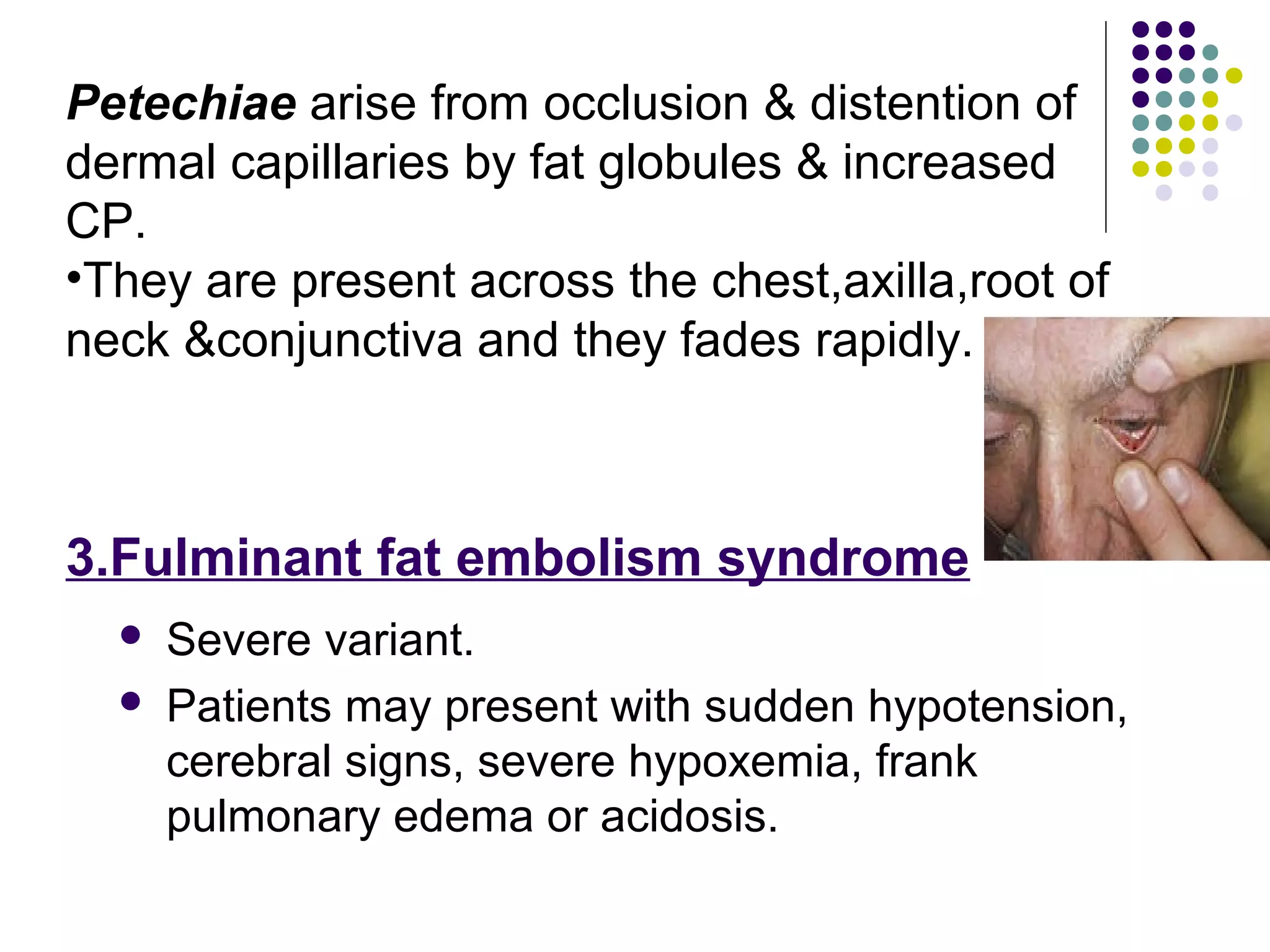 Fat embolism | PPT
