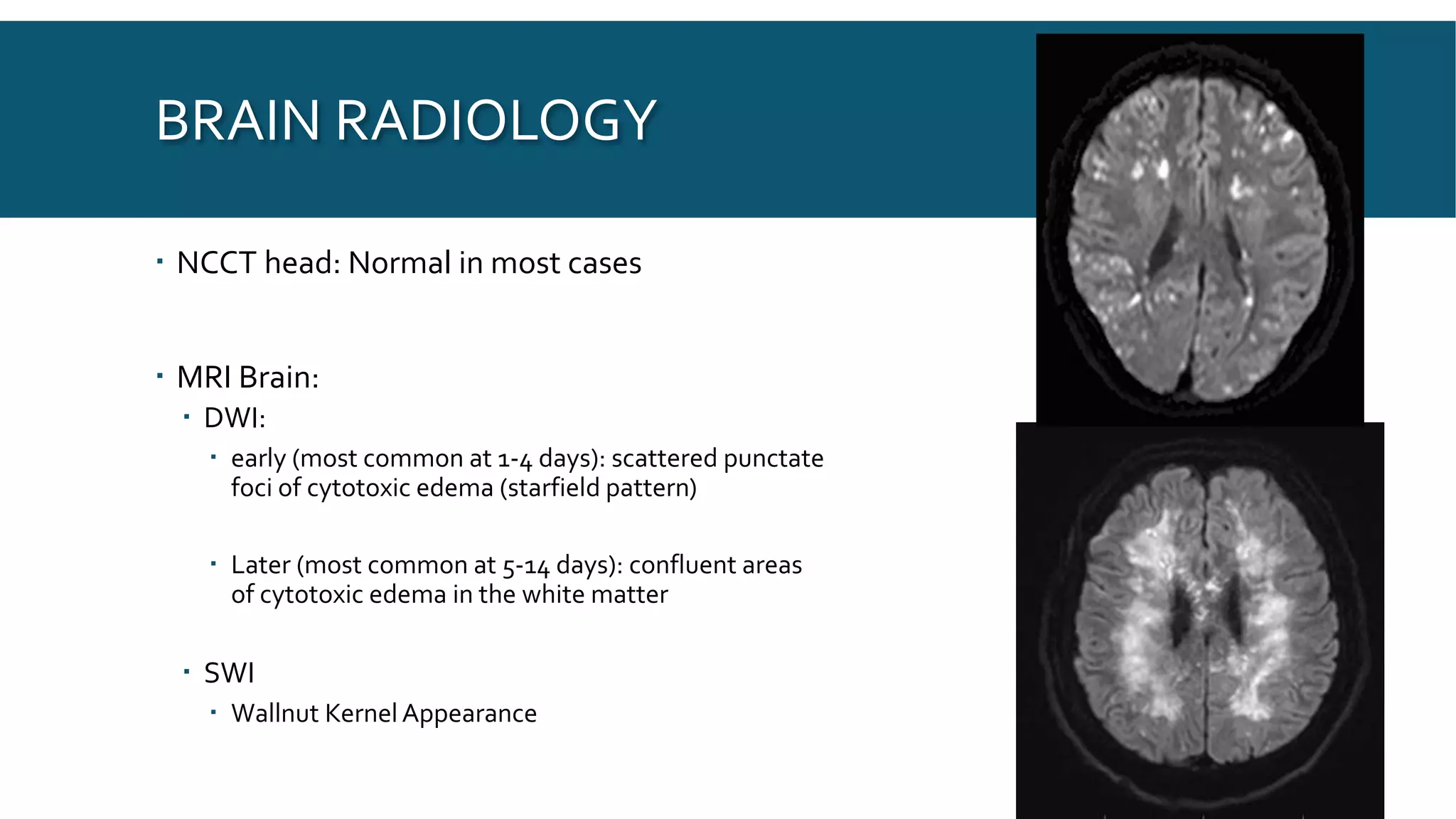 Fat embolism Syndrome | PPTX