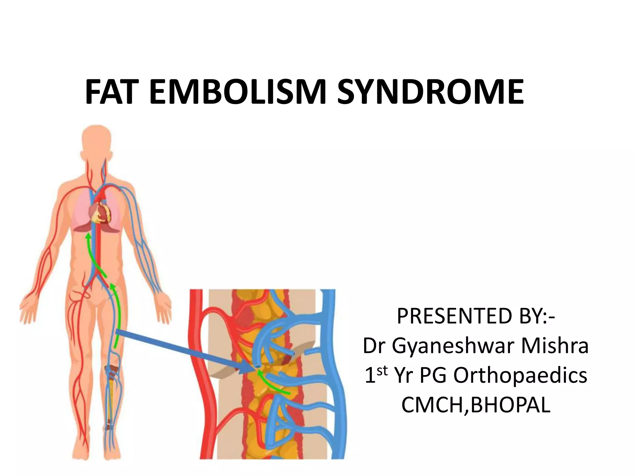 Fat Embolism Dr Gyaan.pptx