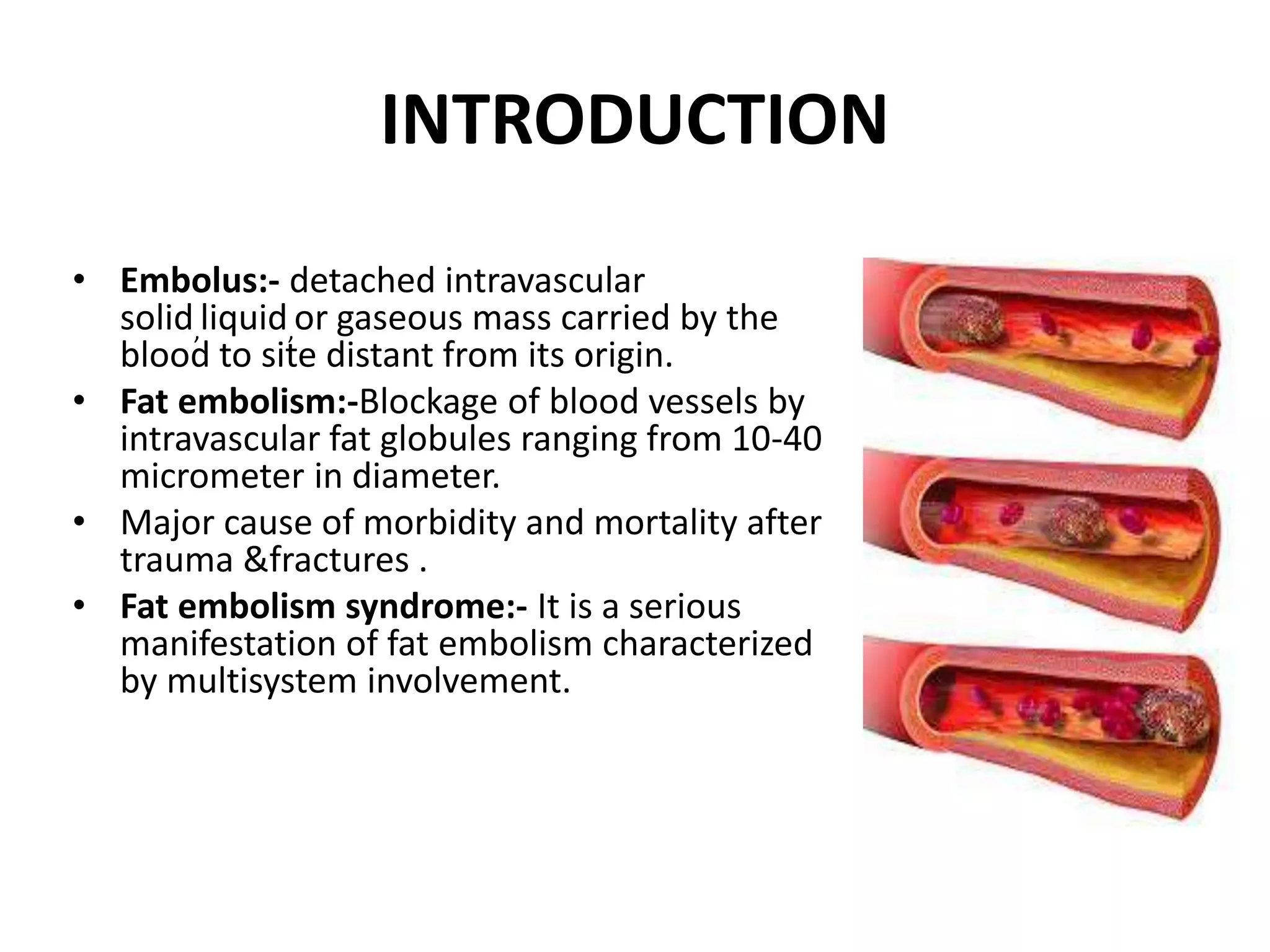 Fat Embolism Dr Gyaan.pptx