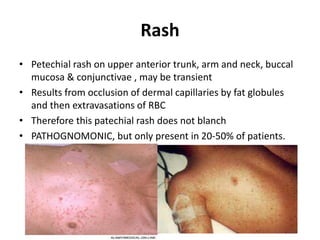 Fat Embolism Dr Gyaan.pptx | Lung and Respiratory Health | Diseases and ...