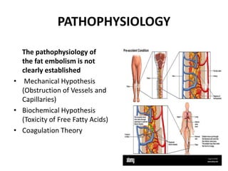 Fat Embolism Dr Gyaan.pptx