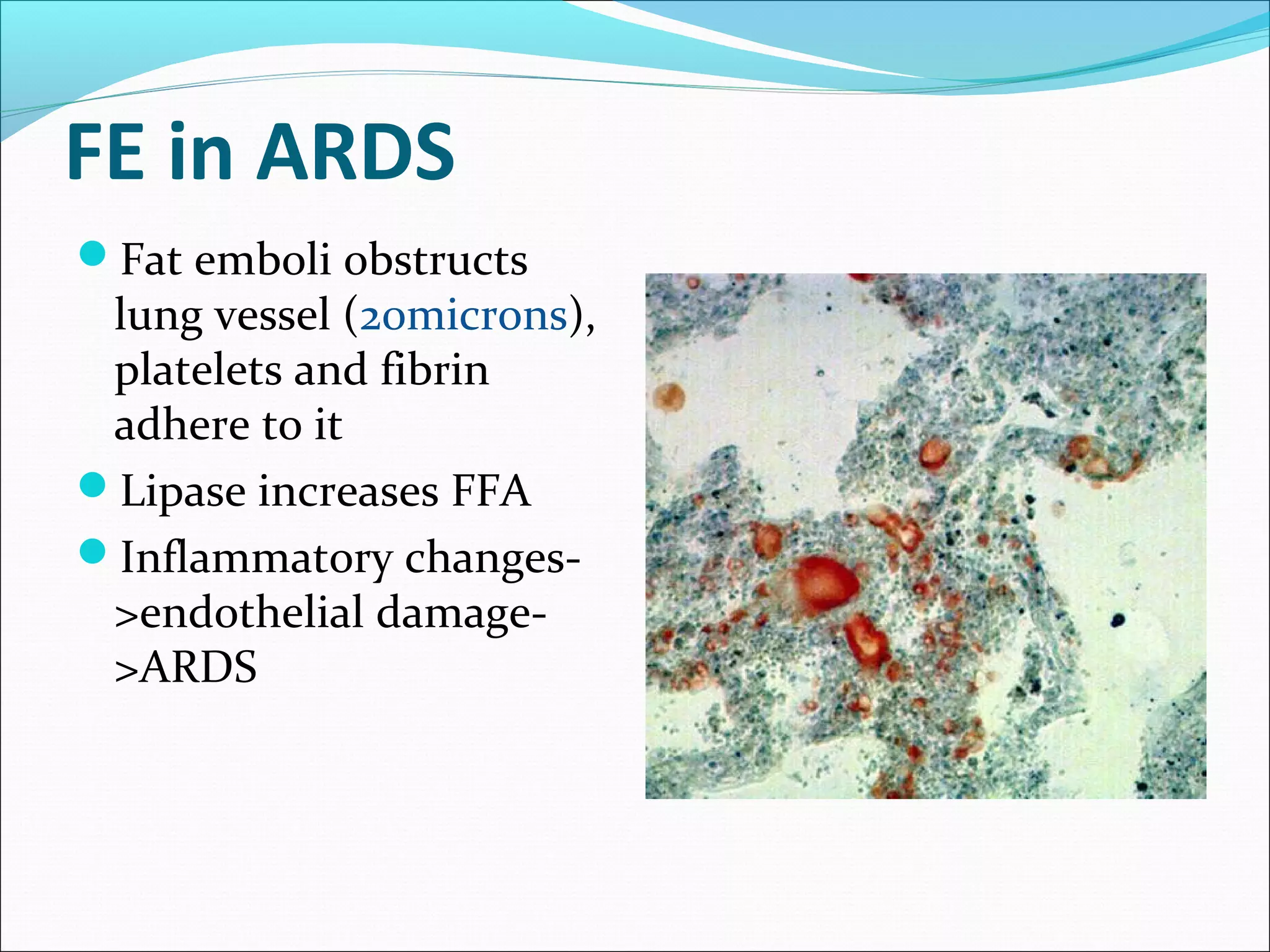 Fat embolism syndrome | PPT