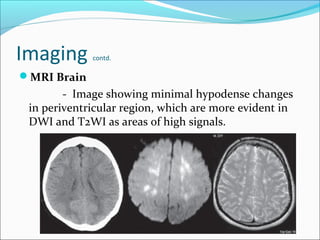 Fat embolism syndrome | PPT