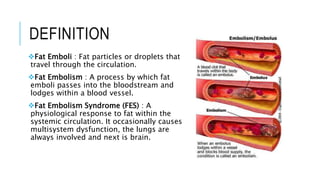 Fat embolism syndrome | PPTX | Bone and Joint Conditions | Diseases and ...