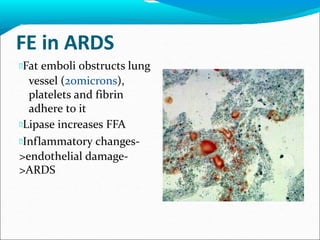 Fat Embolism Syndrome | PPT