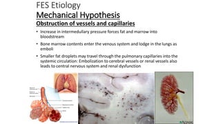 Fat embolism syndrome | PPTX