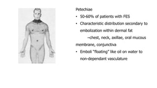 Fat embolism syndrome | PPTX