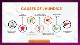 Fate of Hemoglobin and types of Jaundice | PPTX