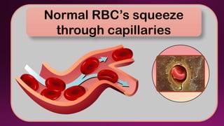 Fate of Hemoglobin and types of Jaundice | PPTX