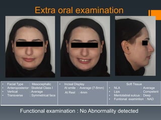 missing laterals | PPTX