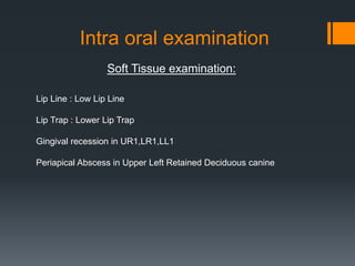 missing laterals | PPTX