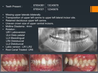 missing laterals | PPTX