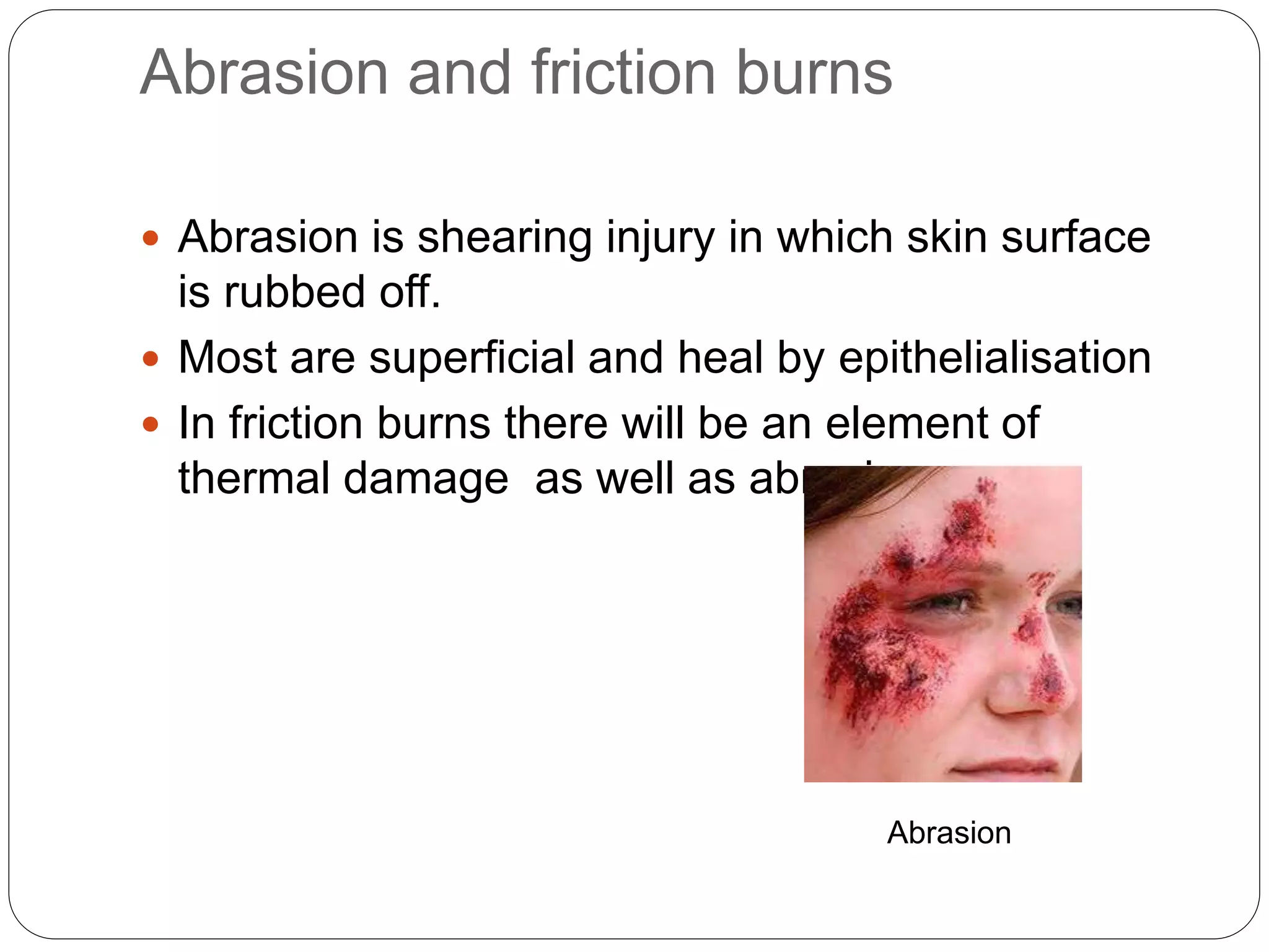 wound healing &ulcer classification | PPTX