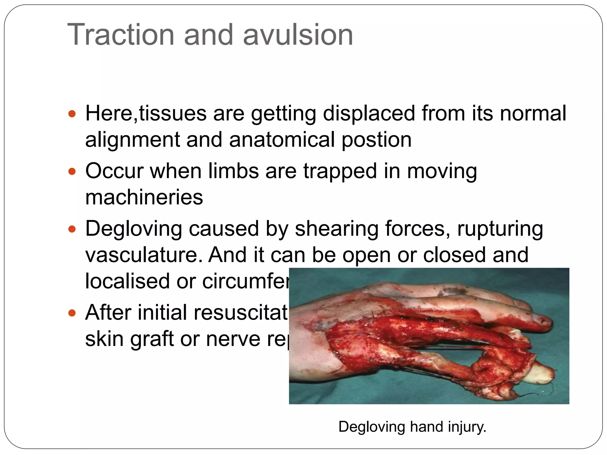 wound healing &ulcer classification | PPTX