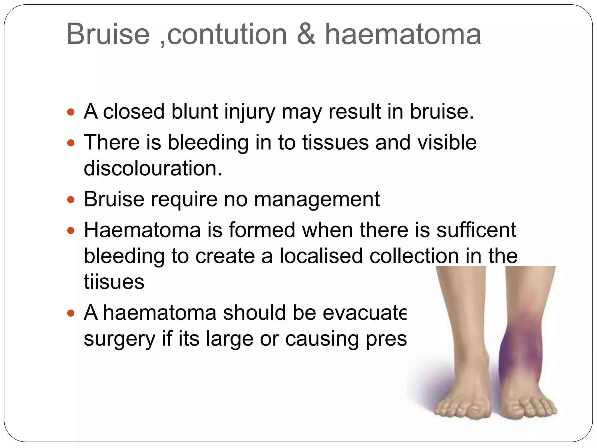 wound healing &ulcer classification | PPTX