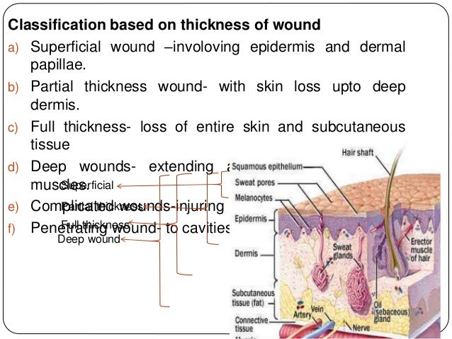 wound healing &ulcer classification