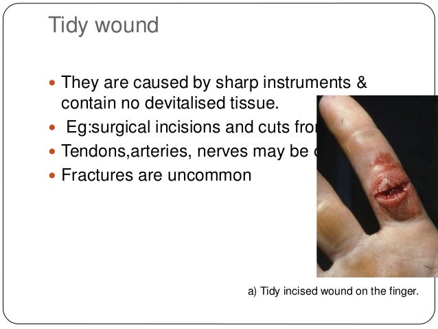 wound healing &ulcer classification