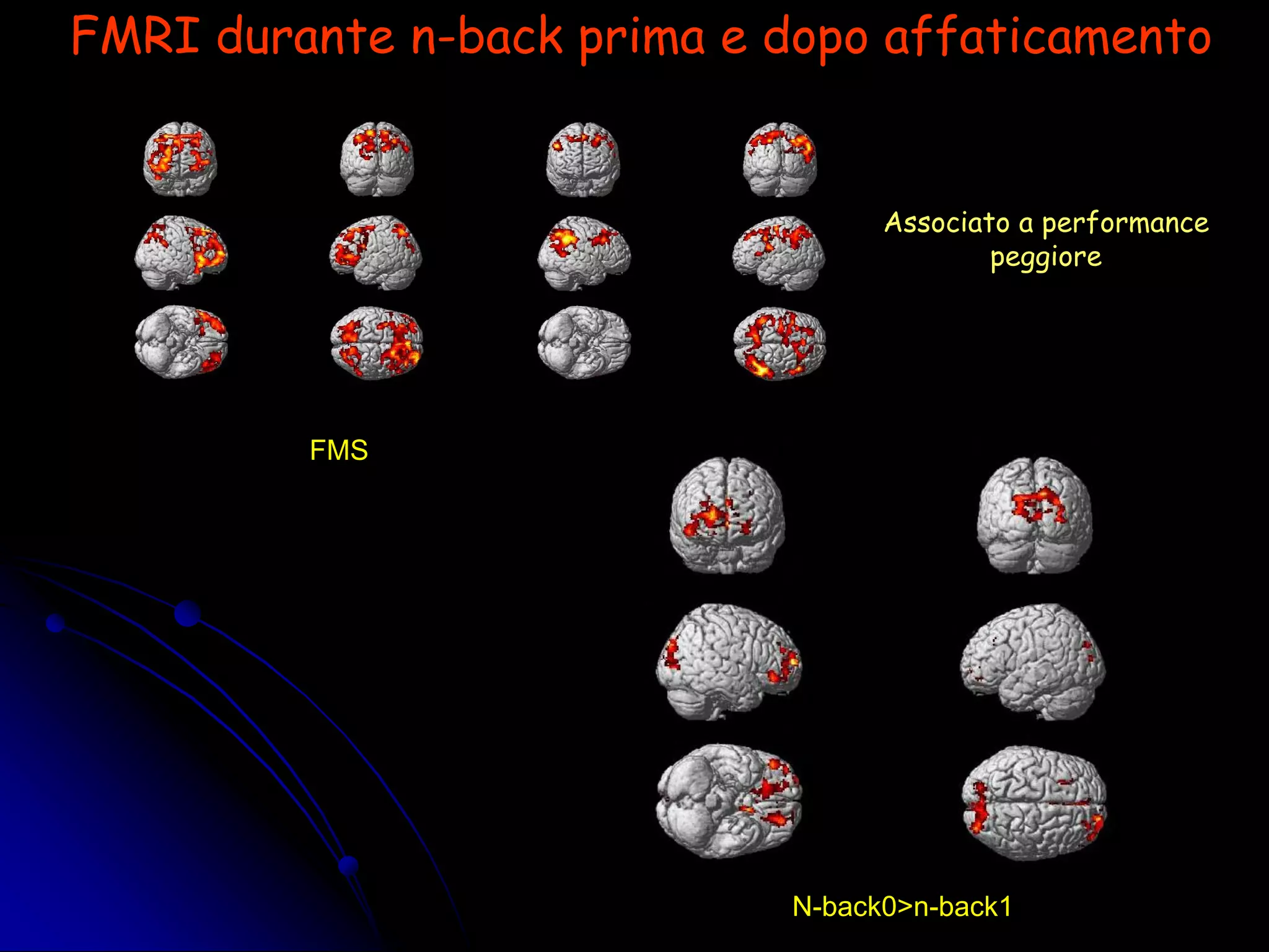 Fatica cognitiva - SCAN Onlus | PDF