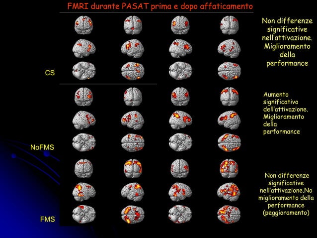 Fatica cognitiva - SCAN Onlus | PDF