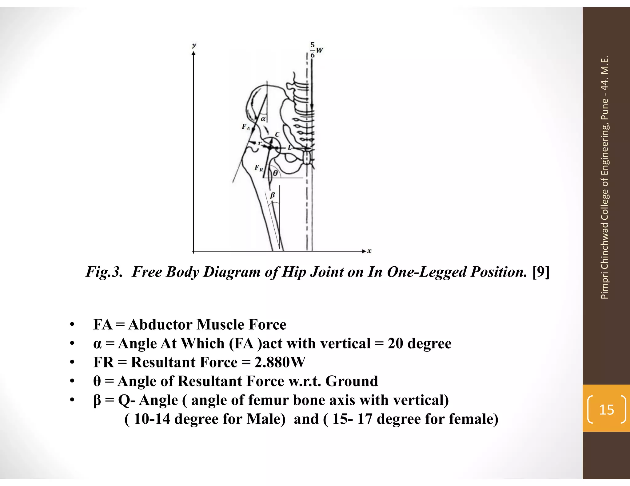 Fatigue life estimation of Human artificial hip joint based on modeling and simulation | PPT