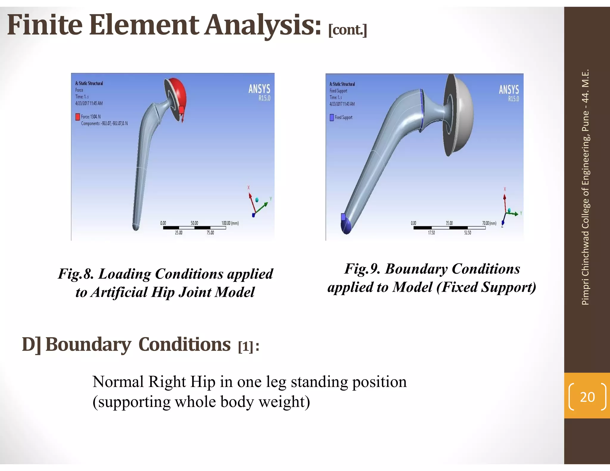 Fatigue life estimation of Human artificial hip joint based on modeling and simulation | PPT