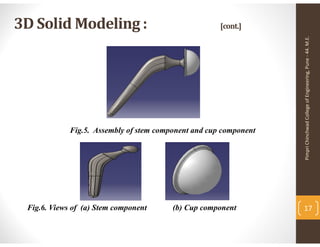 Fatigue life estimation of Human artificial hip joint based on modeling and simulation | PPT