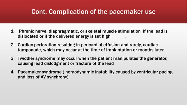 pacemaker | PPTX