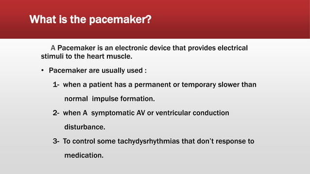 pacemaker | PPTX