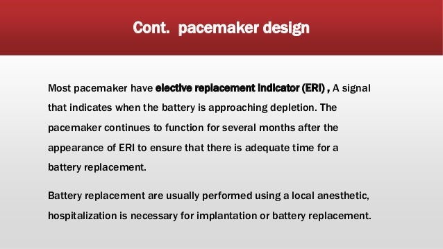 pacemaker