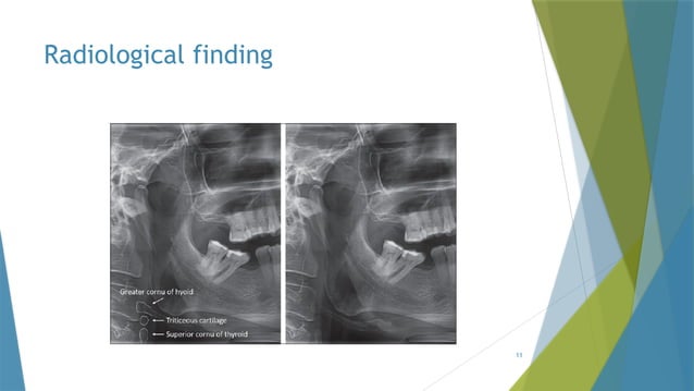 ARTIFACTS IN NECK WHILE CONDUCTING AUTOPSY | PPTX