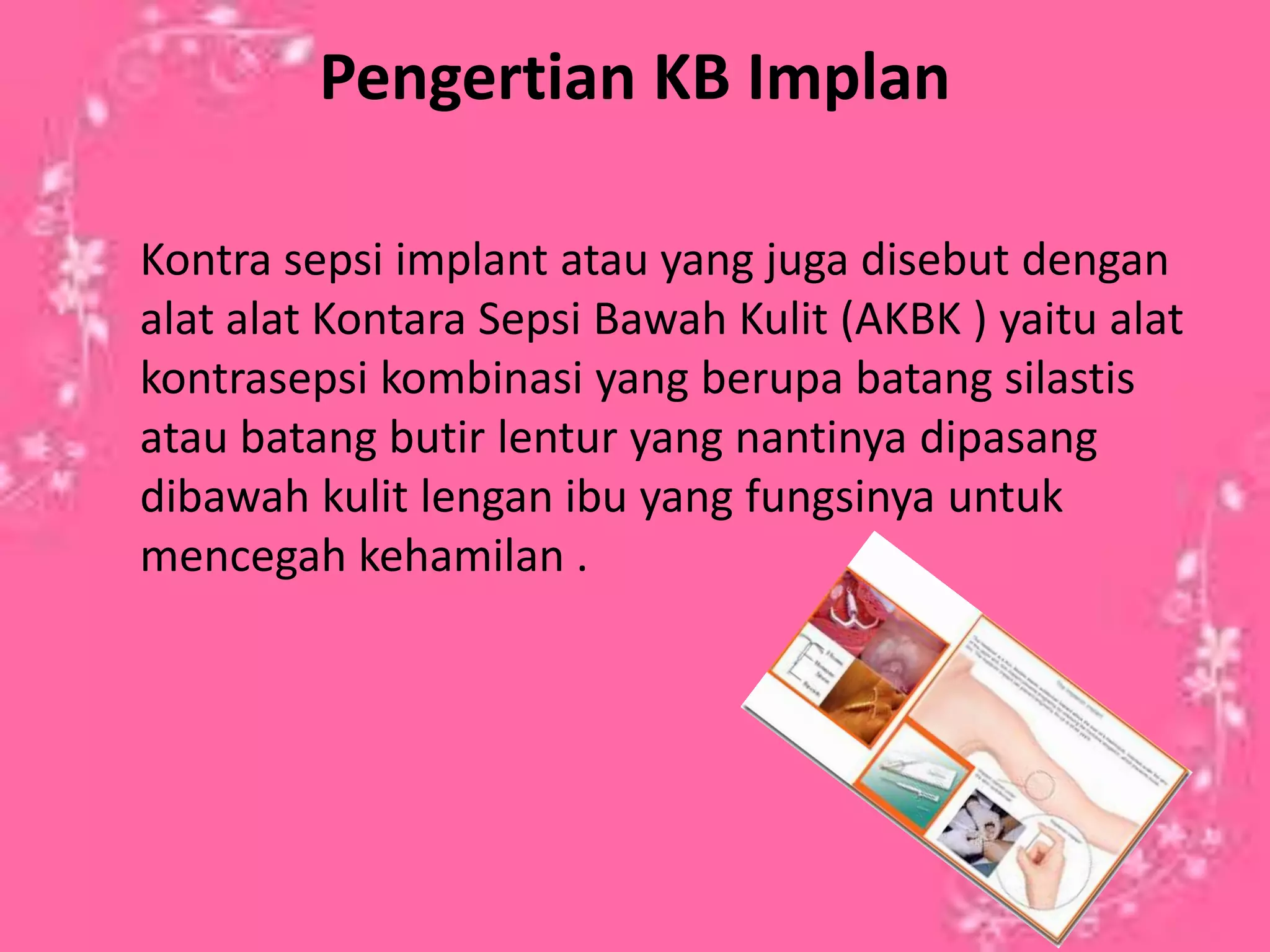 Fatim dan yundr (kb implan) | PPTX