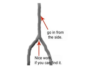 Intravenous Cannulation | PPT