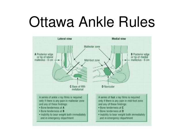 Foot and ankle trauma - Derek Park