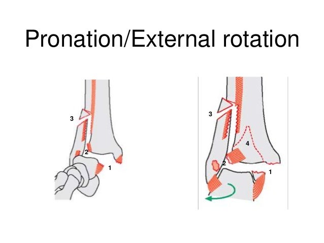 External Rotation Of Ankle