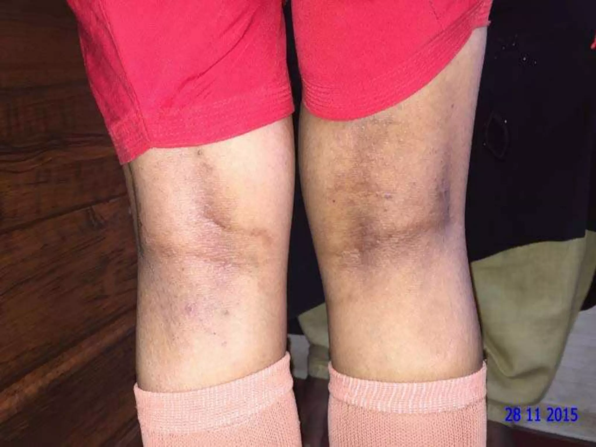 Fats Unit 3rd of nutrition | PPTX