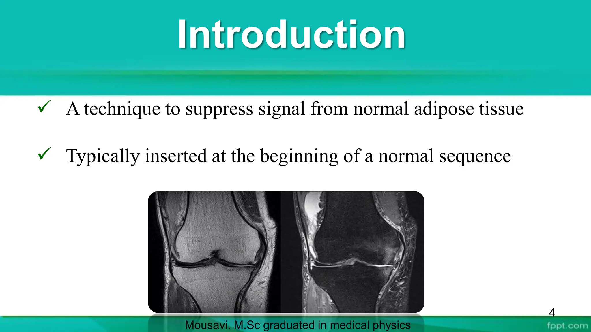 fat suppression in MRI | PPT