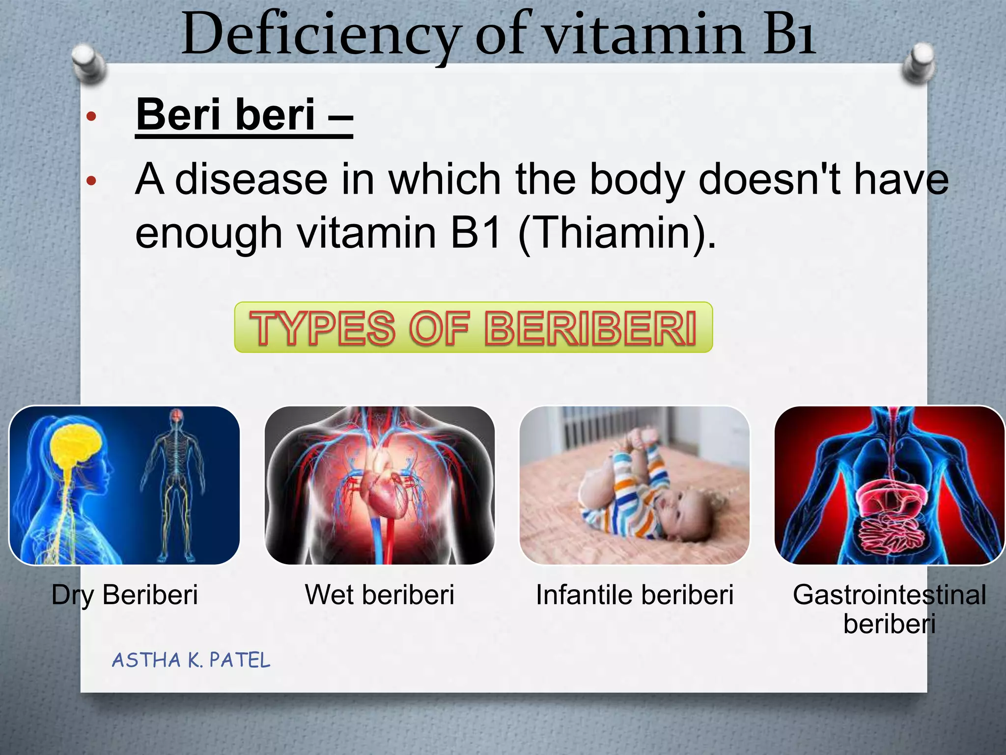 Fat soluble vitamin ( B complex & C ) | PPTX