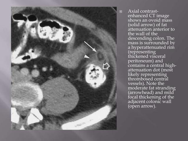 Fat stranding | PPTX