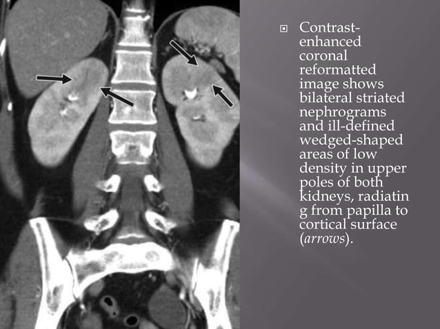 Fat stranding | PPTX