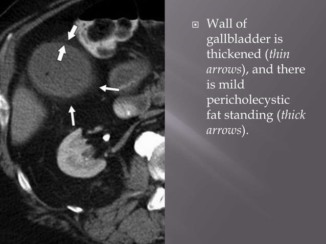 Fat stranding | PPTX