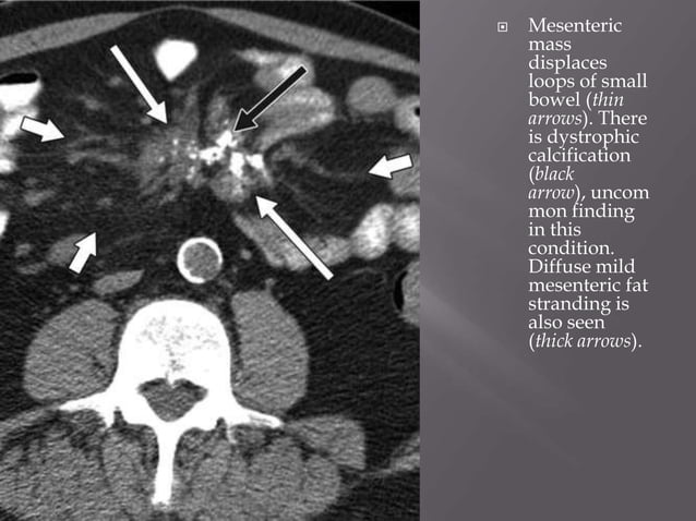 Fat stranding | PPTX