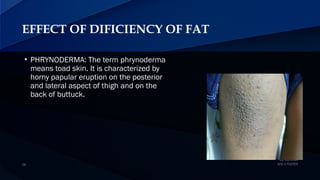 FATS UNIT 4.pptx B.Sc nursing 2nd sem applied nutrition and dietics ...