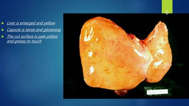 fatty change.pptx | Endocrine and Metabolic Diseases | Diseases and ...