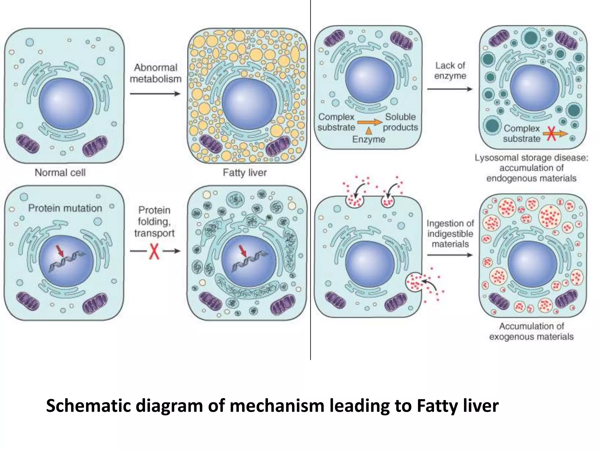 Fatty liver.ppt