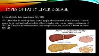 Fatty liver disease.pptx