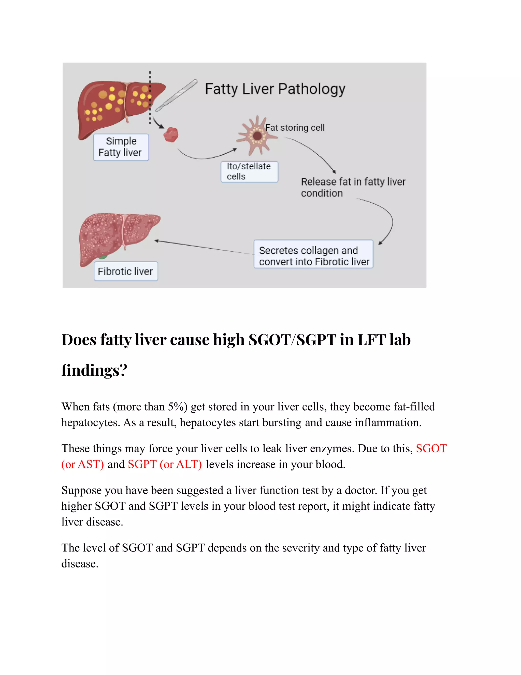fatty liver grades.pdf